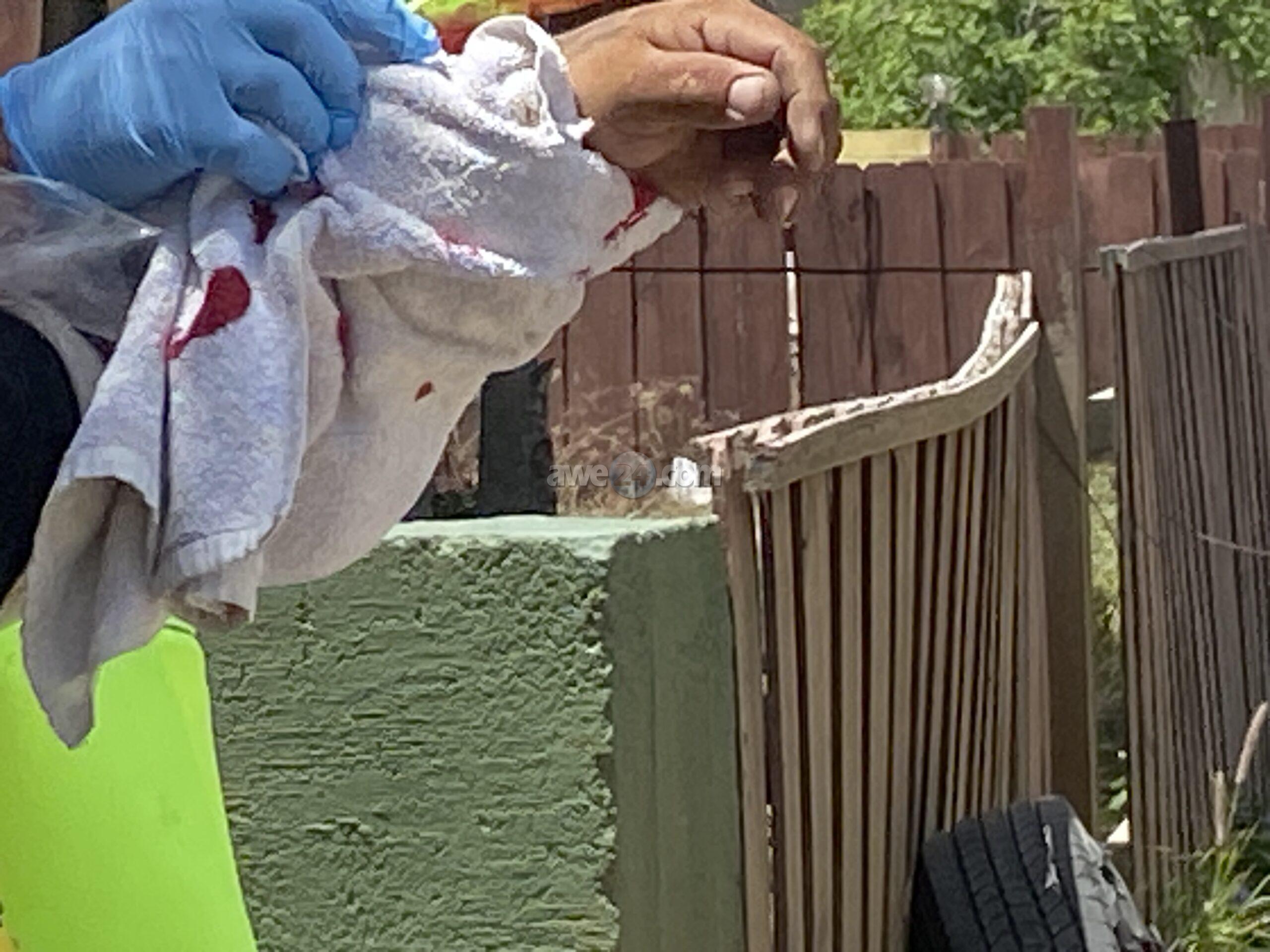 Homber cortando mata cu mashin di zaag a corta su pols cu e mashin ...